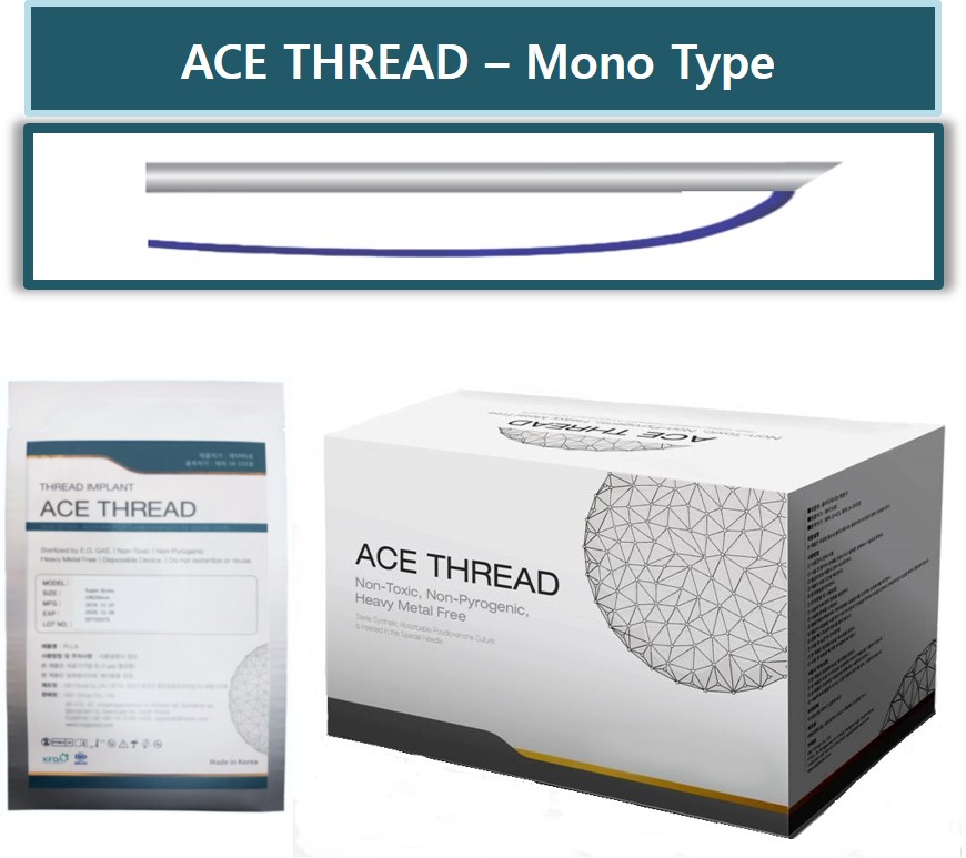 ACE PLLA Thread - Mono Type (100 pcs) - 12 Sizes